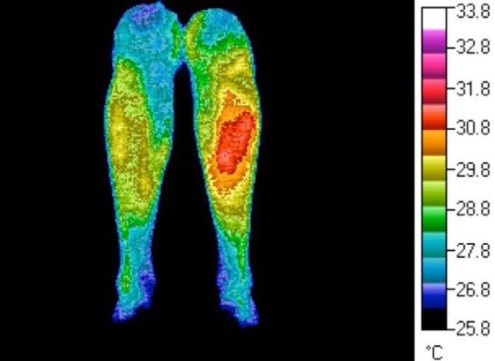 AMI Device Overview | Cyma Technologies